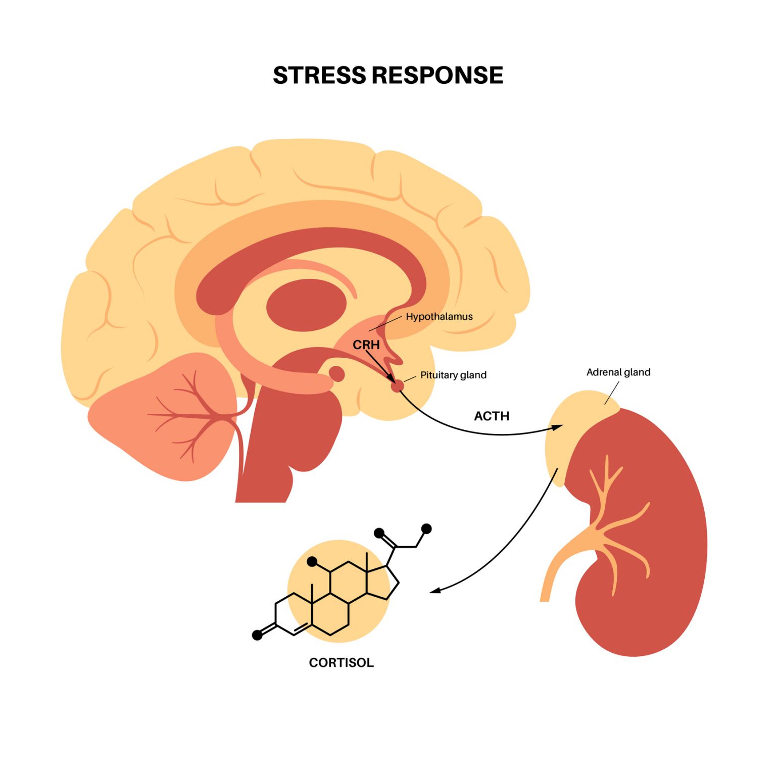 How Stress & Hormonal Imbalances Cause Hair Loss - DiagnosTechs, Inc.