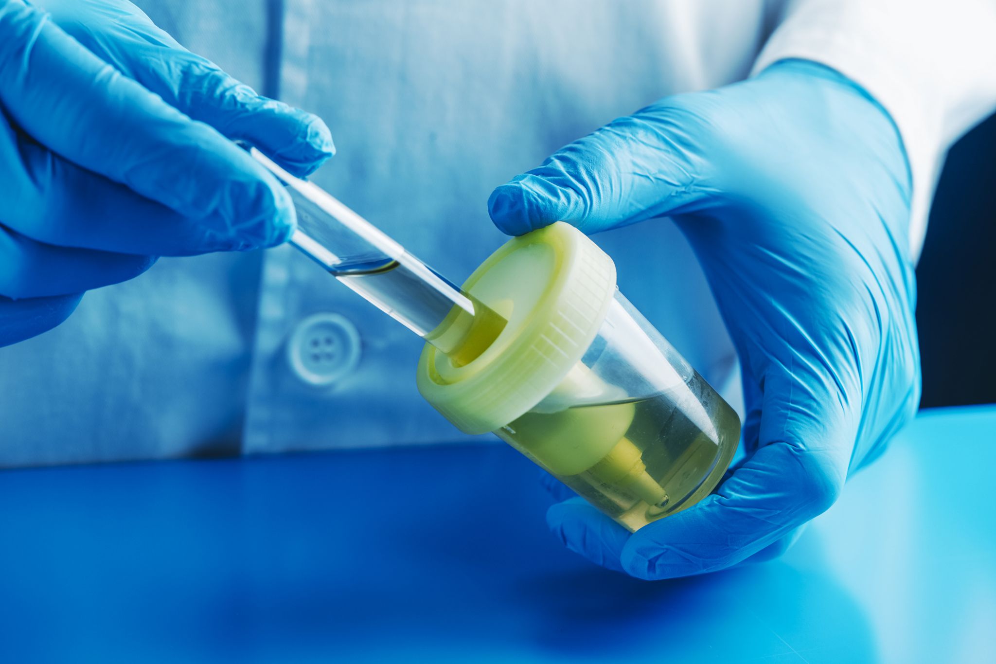 The Toxic Effects of Lead Exposure on Bone Health - DiagnosTechs, Inc.