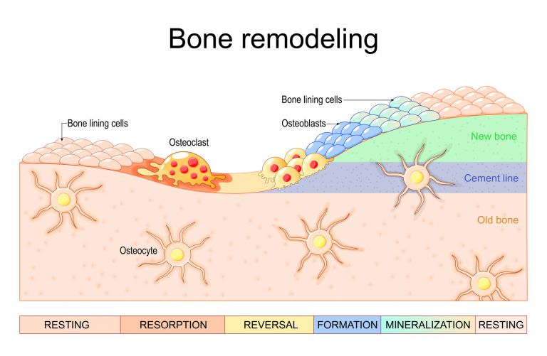 The Toxic Effects of Lead Exposure on Bone Health - DiagnosTechs, Inc.