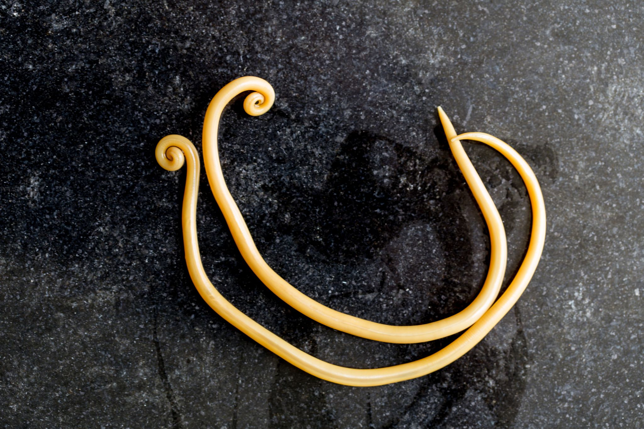 Ascaris lumbricoides (Roundworms) - Overview, Testing & Treatment ...
